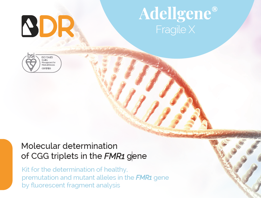 Sindrome X Fragile: test molecolare FMR1 per diagnosi precoce e ...